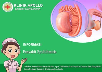Penyakit Epididimitis: Tanda dan Pengobatan | Klinik Apollo Jakarta