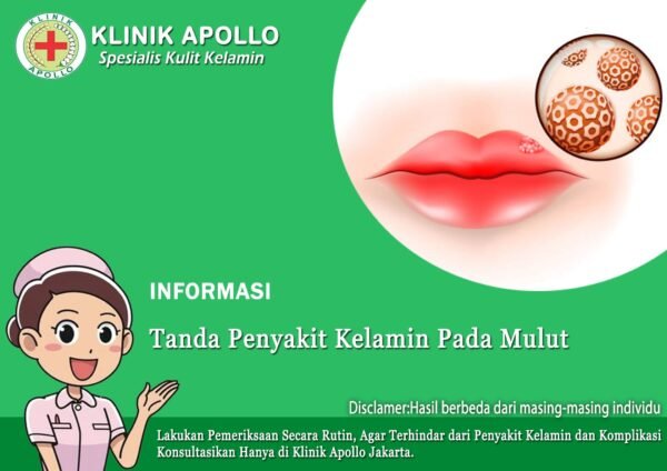 Penyakit Kelamin pada Mulut Mengintai? Kenali Tanda Itu di Sini ...