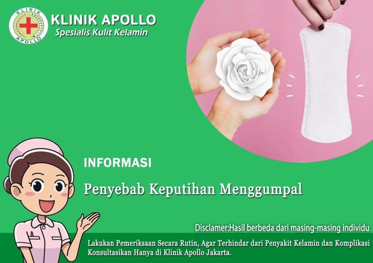 Penyebab Keputihan Menggumpal dan Gejalanya yang Bikin Gatal | Klinik ...