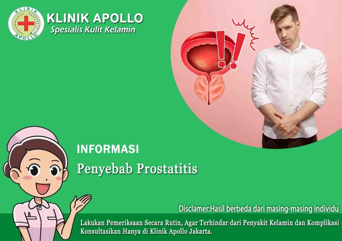 Penyebab Prostatitis: Biang Masalah bagi Kelenjar Prostat | Klinik ...
