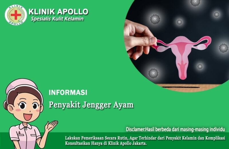 Bahaya bagi Kesehatan, Inilah Penyakit Jengger Ayam | Klinik Apollo Jakarta