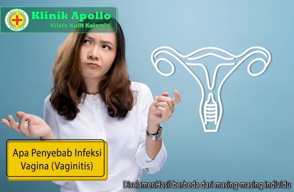 Tanda-Tanda Infeksi Vagina (Vaginitis) yang Wajib Diwaspadai | Klinik ...