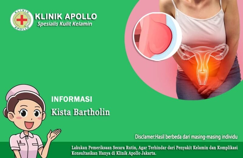 Apakah Kista Bartholin Harus Dioperasi? Ini Penjelasannya | Klinik ...