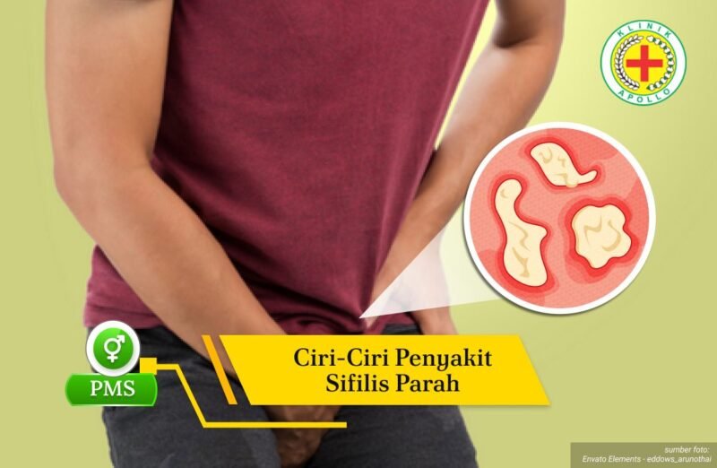 Inilah 5 Ciri-ciri Penyakit Sifilis Parah Tanpa Penanganan Tepat ...
