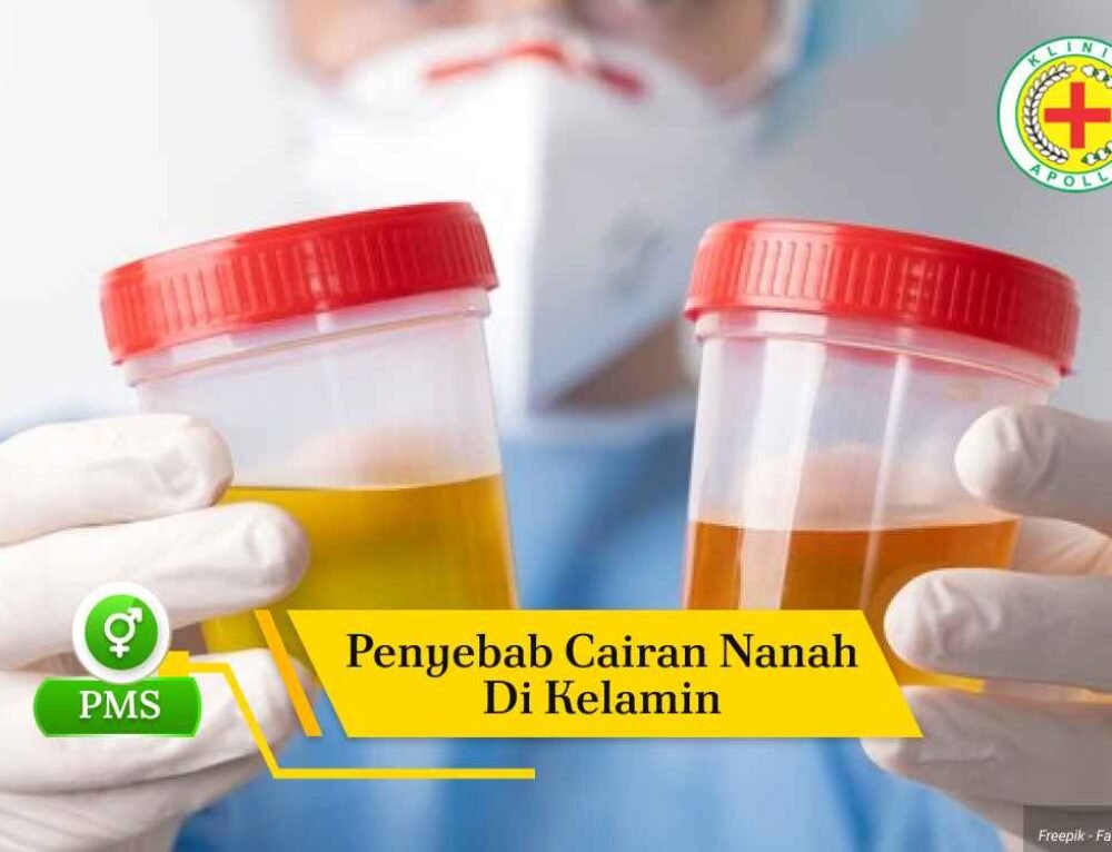 Waspada Keputihan Berwarna Coklat Pertanda Infeksi | Klinik Apollo Jakarta Waspada Keputihan Berwarna Coklat Pertanda Infeksi | Klinik Apollo Jakarta